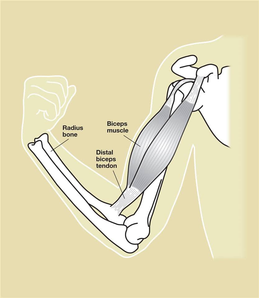Tendao Distal Do Biceps